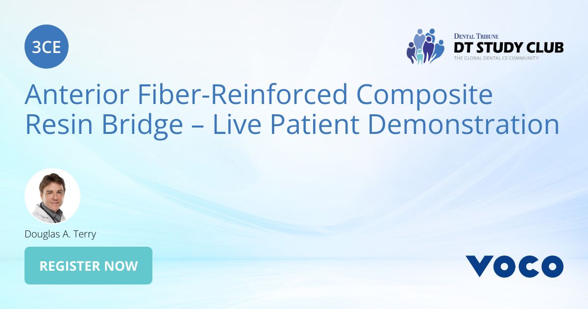 Anterior Fiber-Reinforced Composite Resin Bridge – Live Patient ...