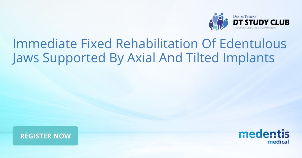 Immediate Fixed Rehabilitation Of Edentulous Jaws Supported By Axial And Tilted Implants ...