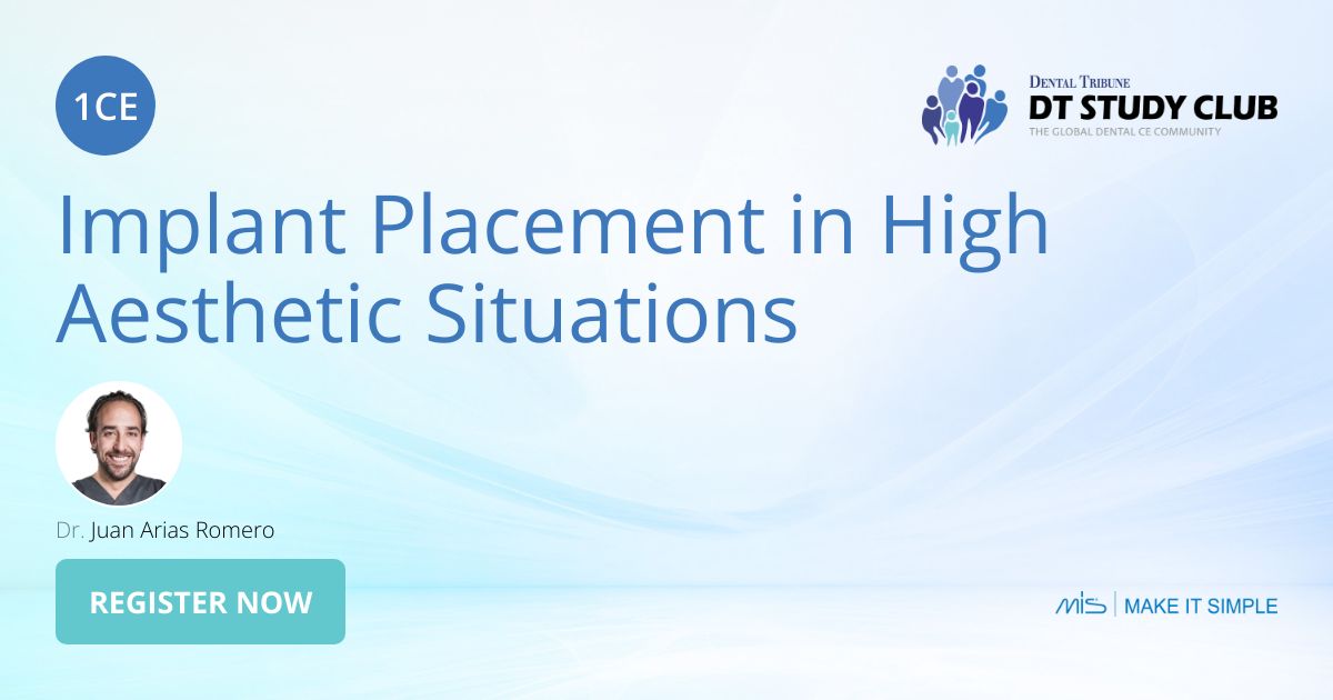 Implant Placement in High Aesthetic Situations - Webinar - DTStudyClub