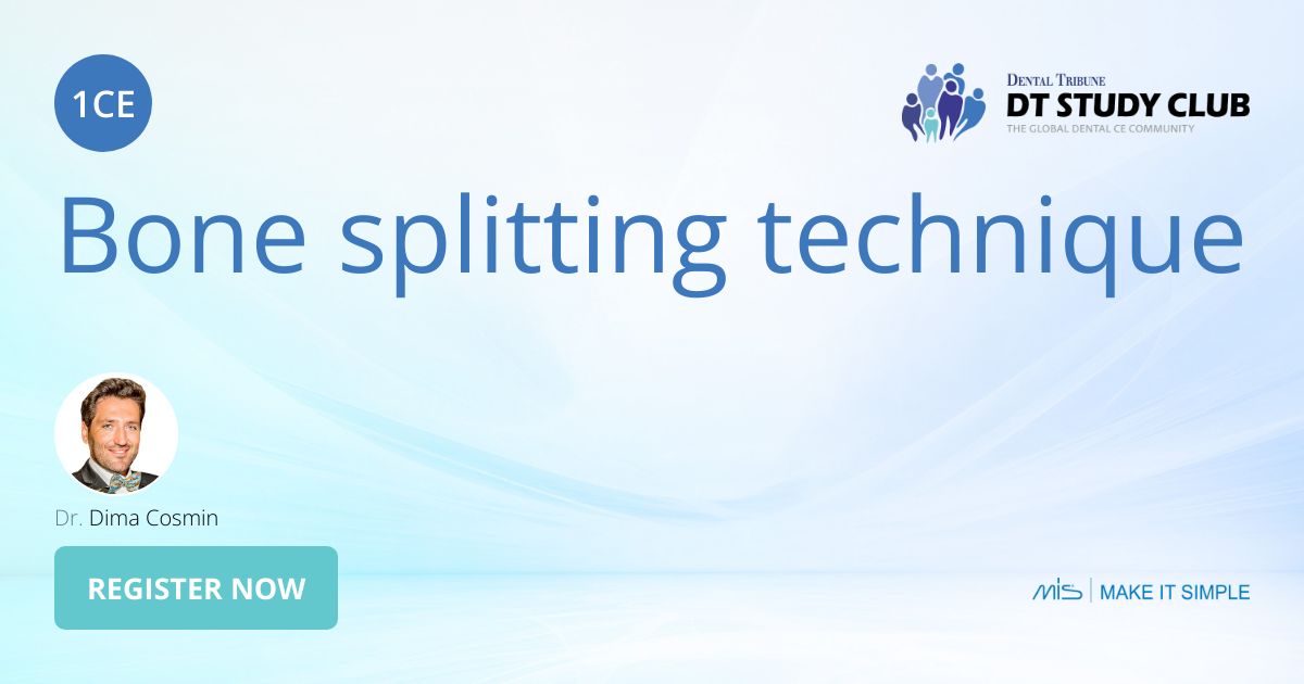 Bone splitting technique - Webinar - DTStudyClub