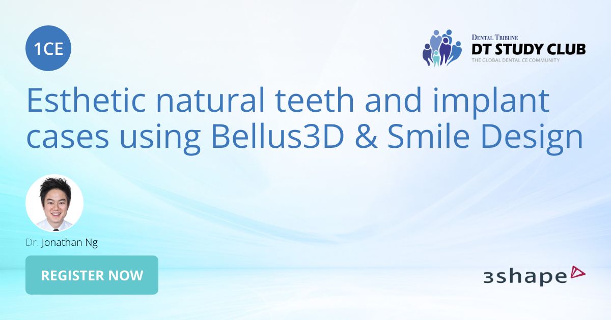 Esthetic natural teeth and implant cases using Bellus3D & Smile Design ...