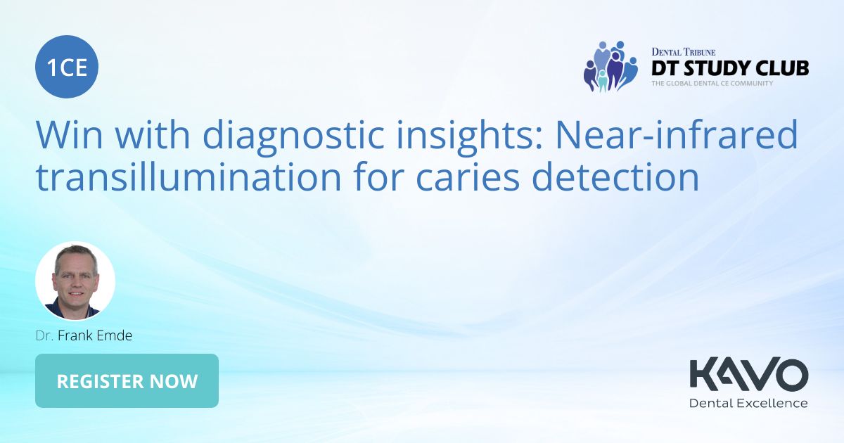 Win With Diagnostic Insights Near Infrared Transillumination For Caries Detection Webinar