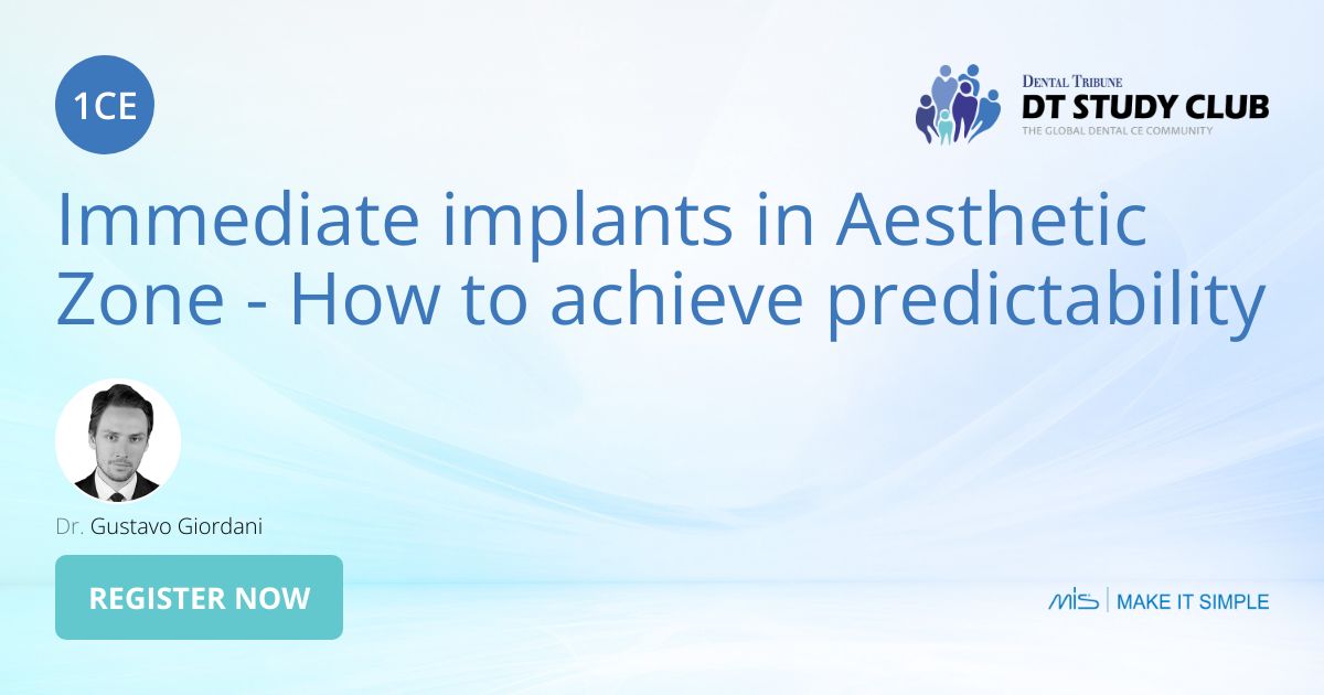 Immediate implants in Aesthetic Zone - How to achieve predictability ...
