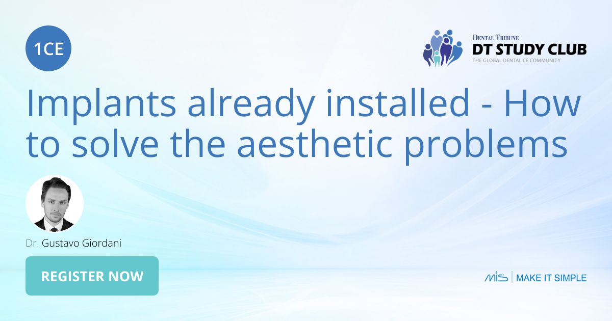 Implants already installed - How to solve the aesthetic problems ...