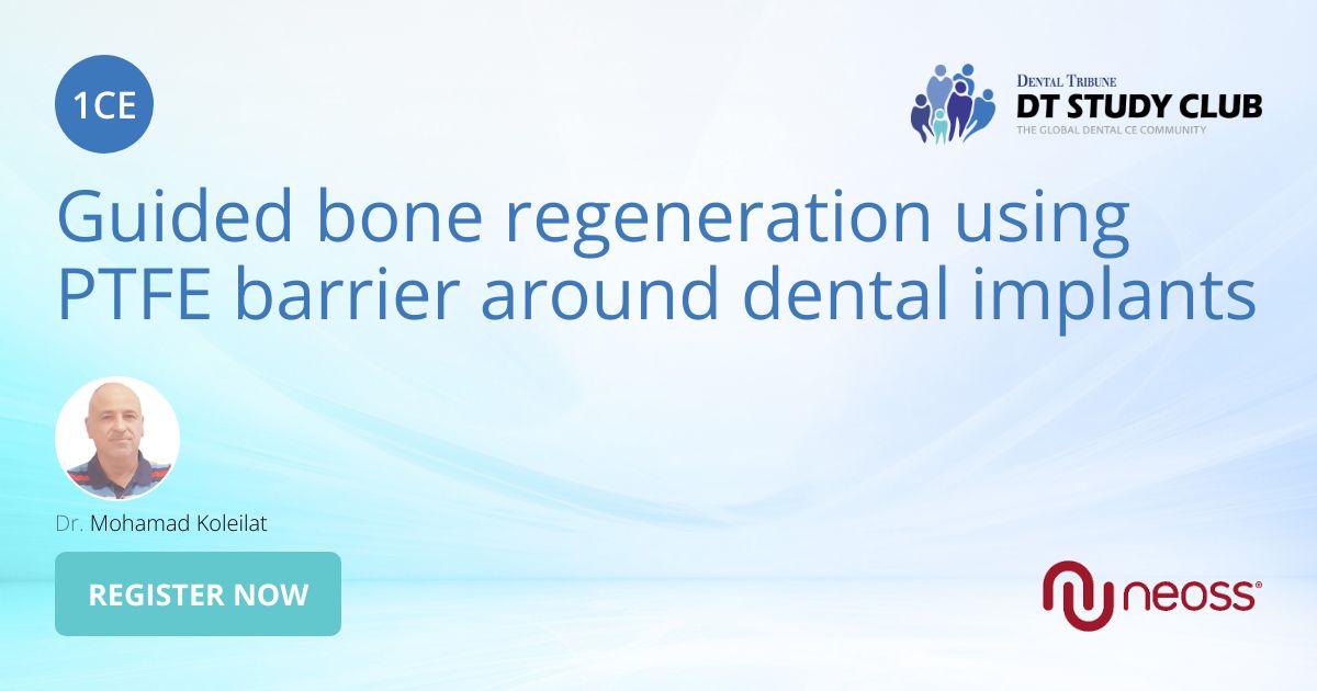 Guided bone regeneration using PTFE barrier around dental im