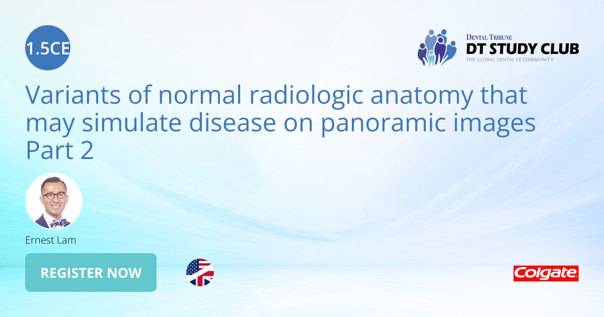 Variants of normal radiologic anatomy that may simulate disease on ...