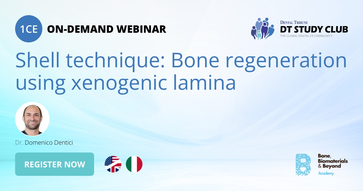 Shell technique: Bone regeneration using xenogenic lamina - Webinar ...