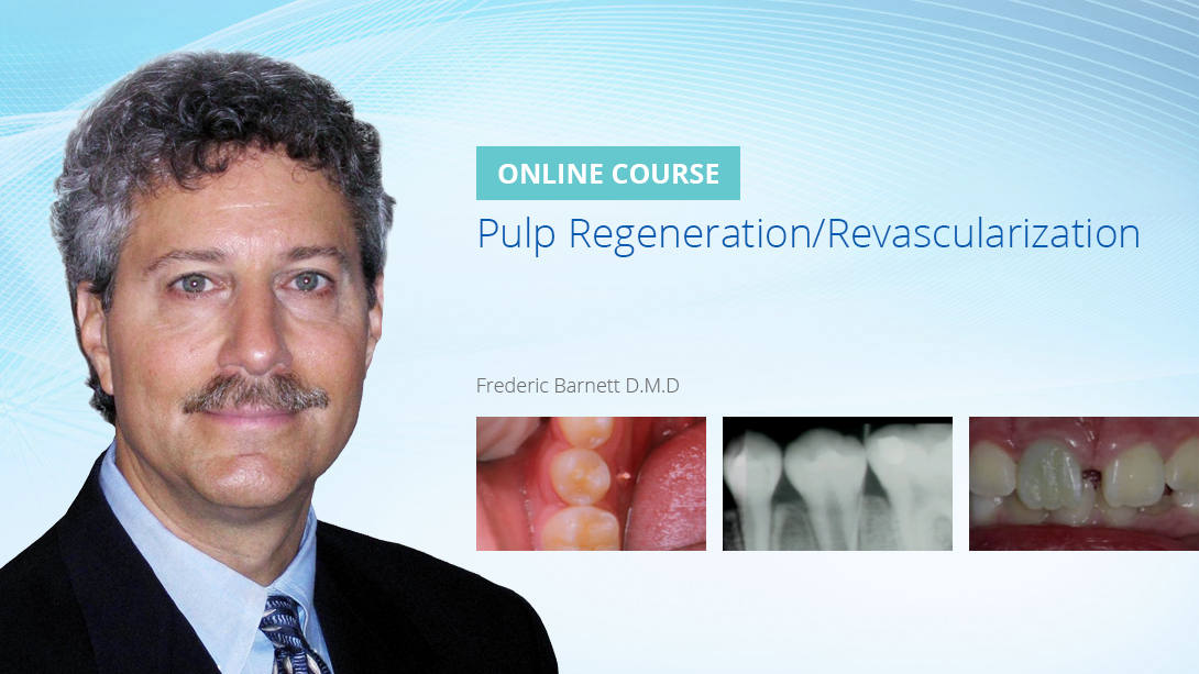 DT Study Club Webinar: Pulp Regeneration/Revascularization
