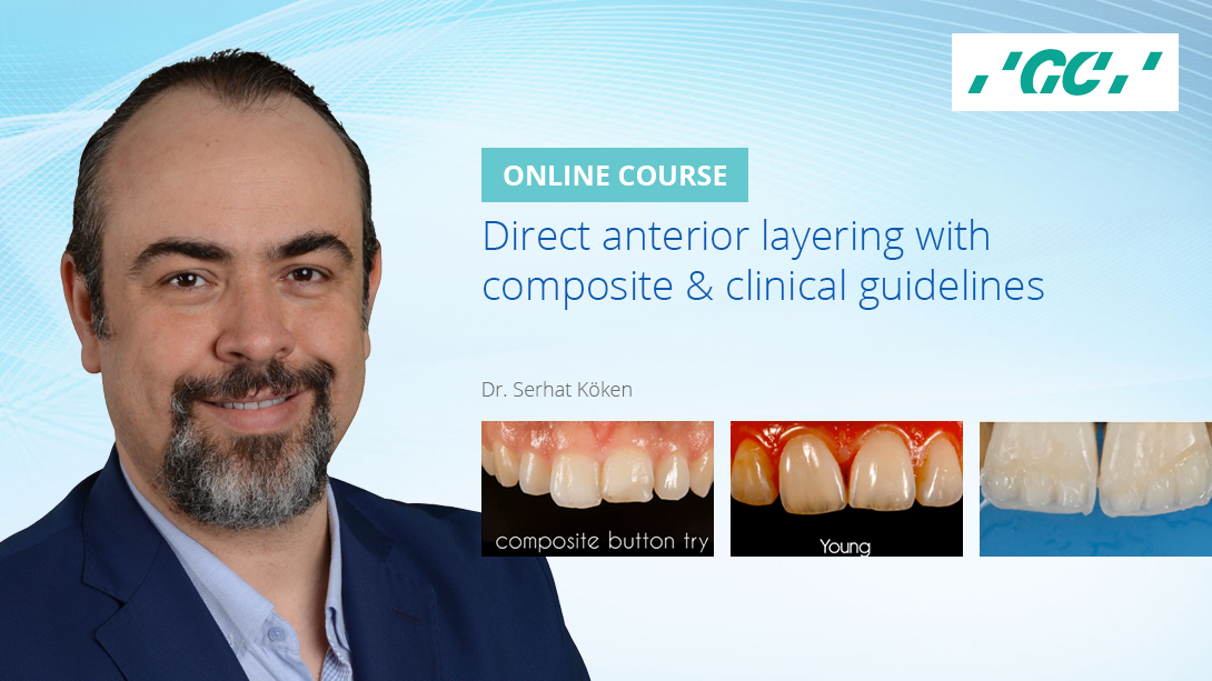 DT Study Club Webinar: Direct anterior layering with composite ...
